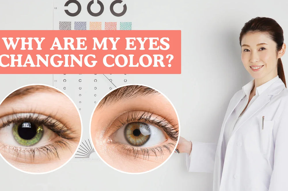 Why Are My Eyes Changing Color? An Optometrist Explains the Causes ...