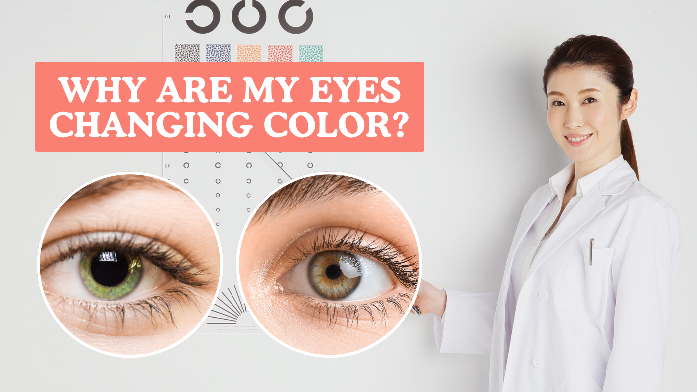 Why Are My Eyes Changing Color? An Optometrist Explains the Causes ...